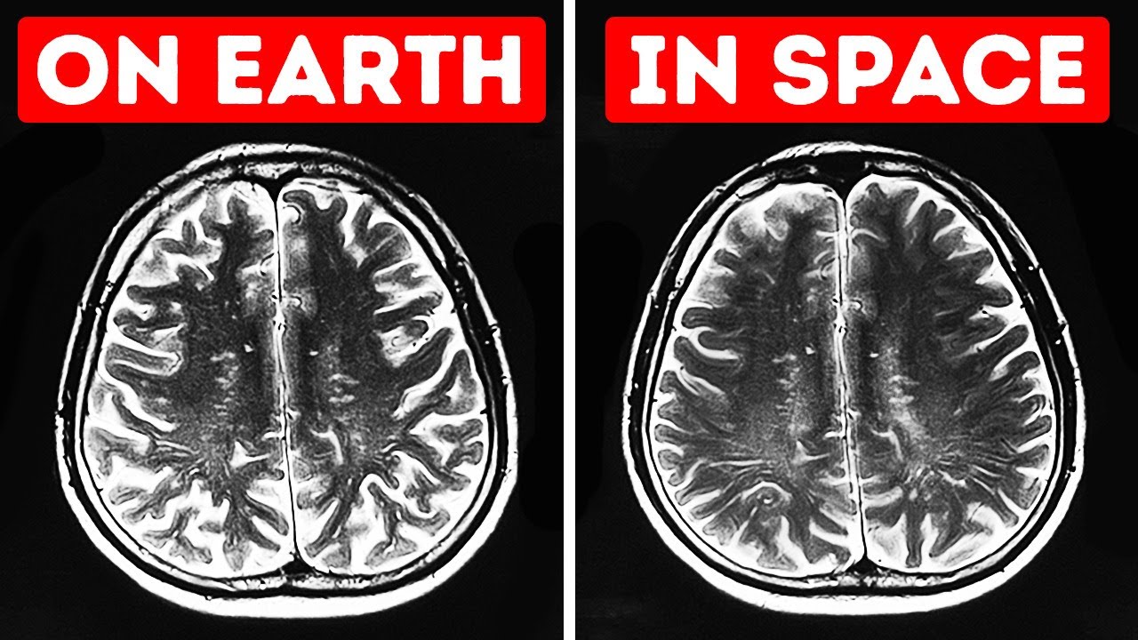 Astronauts Reveal Brain Changes After Time in Space and 41 Body Facts ...