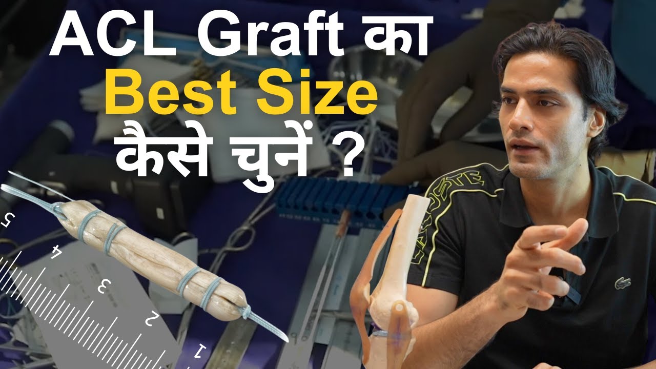 ACL Ligament ग्राफ्ट का Size कैसे चुनें ? Ideal Graft Length & Diameter ...