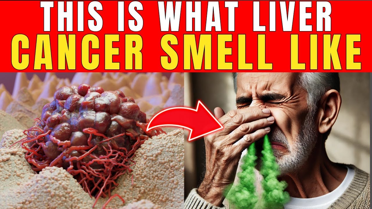 🚨 ALERT! THESE ARE LIVER CANCER SMELLS PEOPLE DON'T PAY ATTENTION TO ...