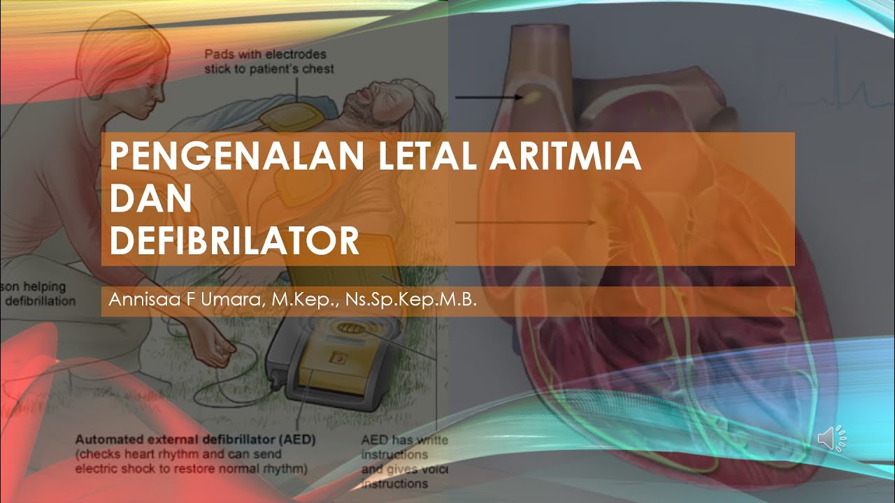 Pengenalan Aritmia yang Mengancam Jiwa (Letal Aritmia) - YouTube