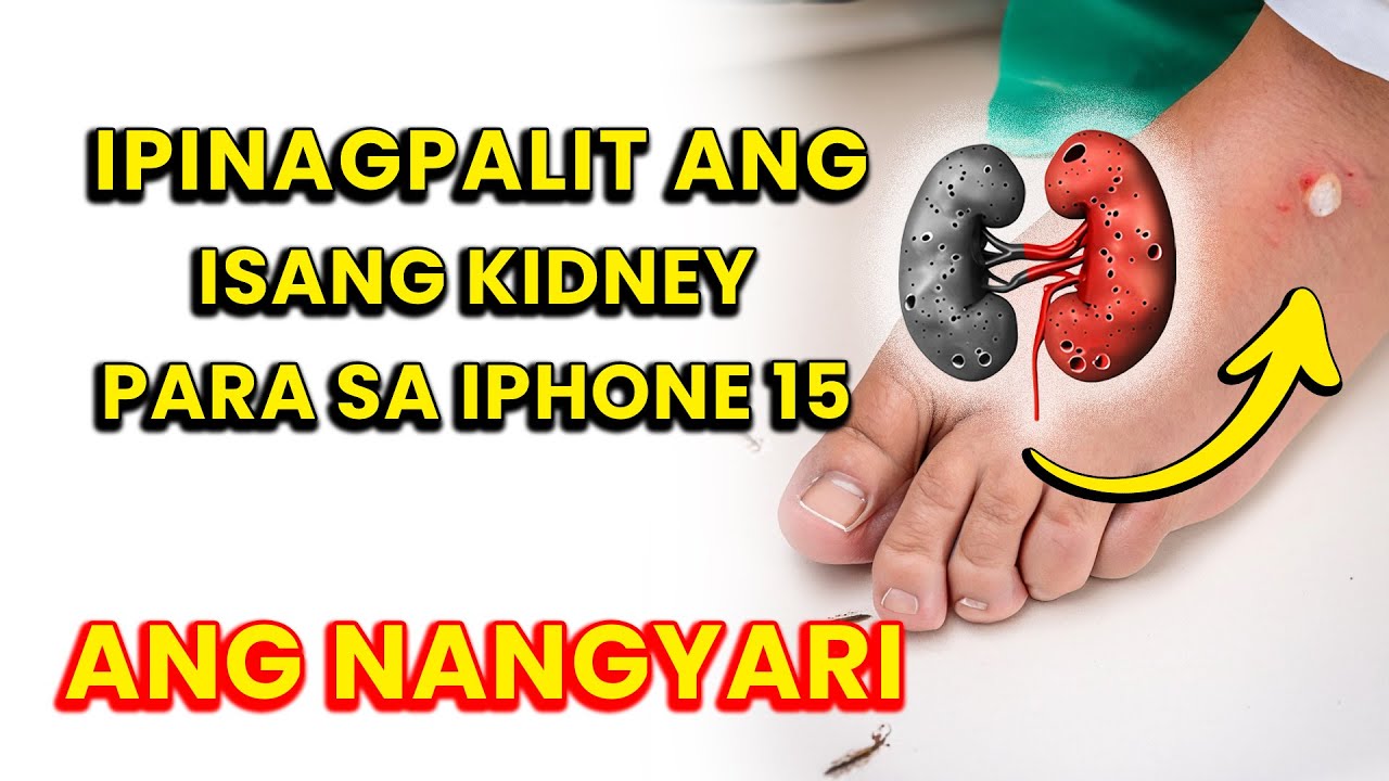 Ang Mangyayari sa Katawan Mo kapag Iisa na lang ang iyong Kidney! - YouTube