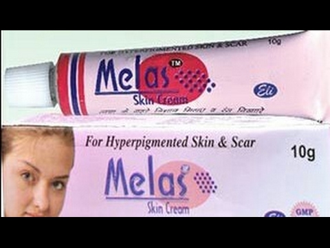 Melas cream full review and side effects in hindi - YouTube
