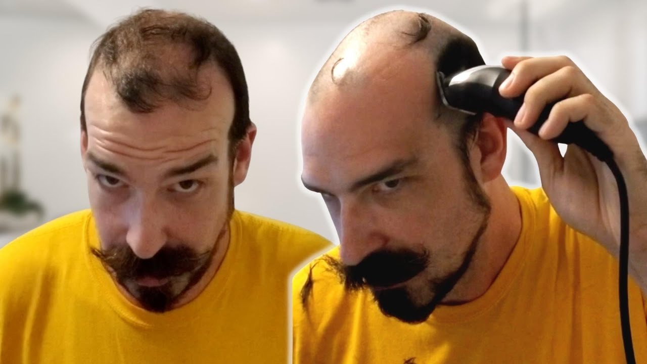 BALDING MAN Has EPIC HEAD SHAVE TRANSFORMATION *Incredible!* - YouTube