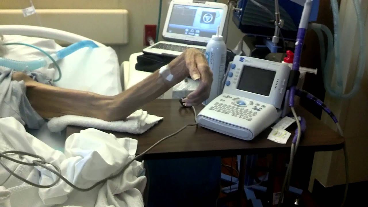 3CG/ultrasound bedside setup left sided - YouTube