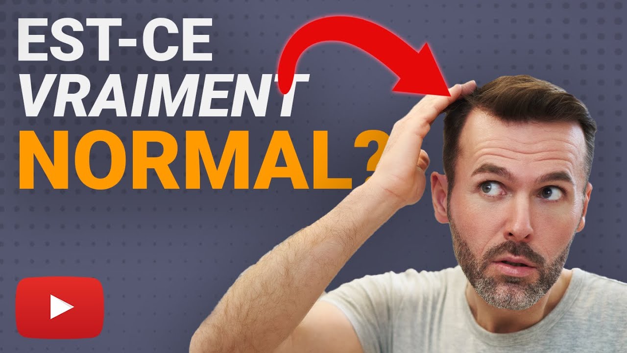 Avez-vous une ligne de frontale dégarnie ou une ligne de frontale ...