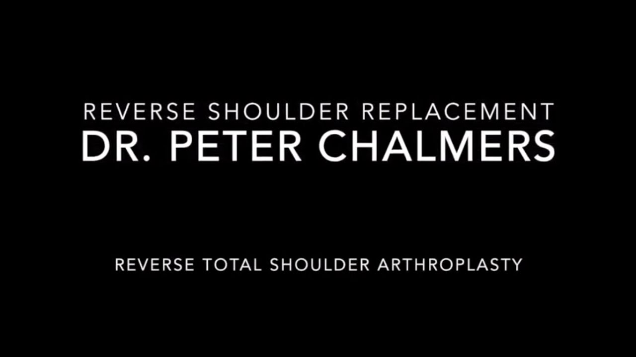 Reverse Shoulder Replacement Patient Version YouTube reverse-shoulder-replacement-patient-version-youtube