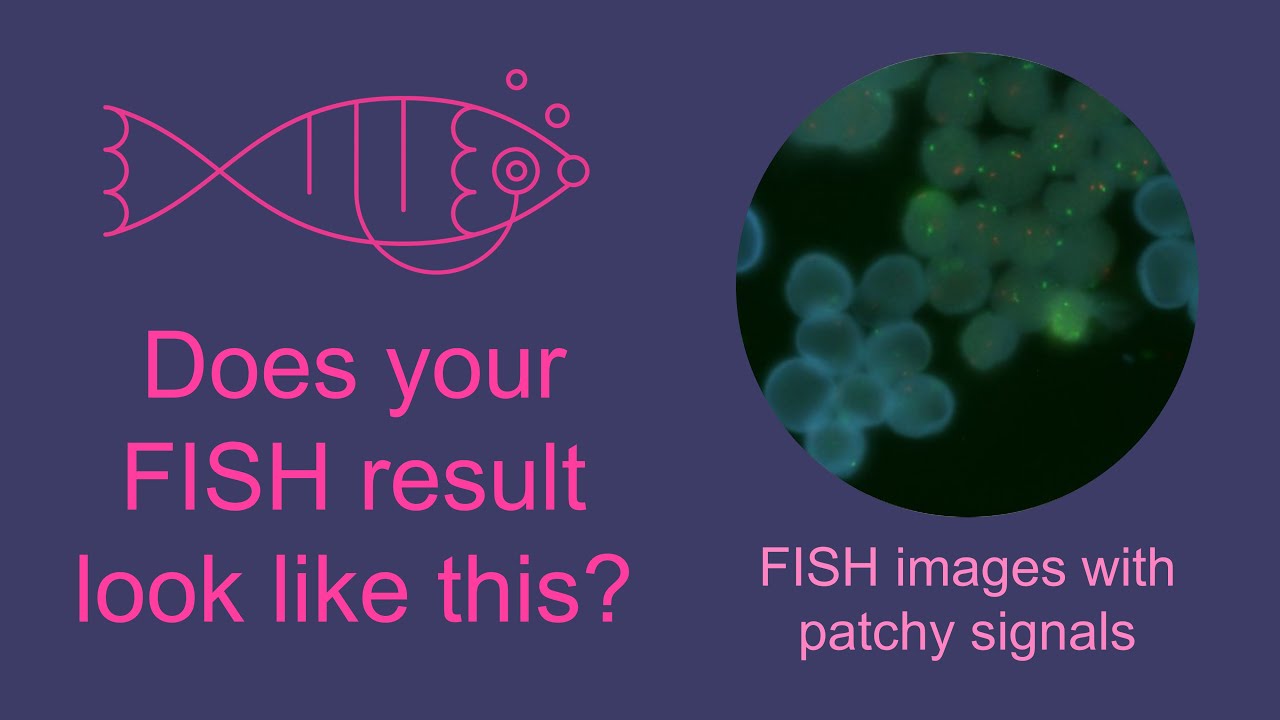 CytoCell FISH 'n' Tips: Probe application - Tips to prevent patchy ...