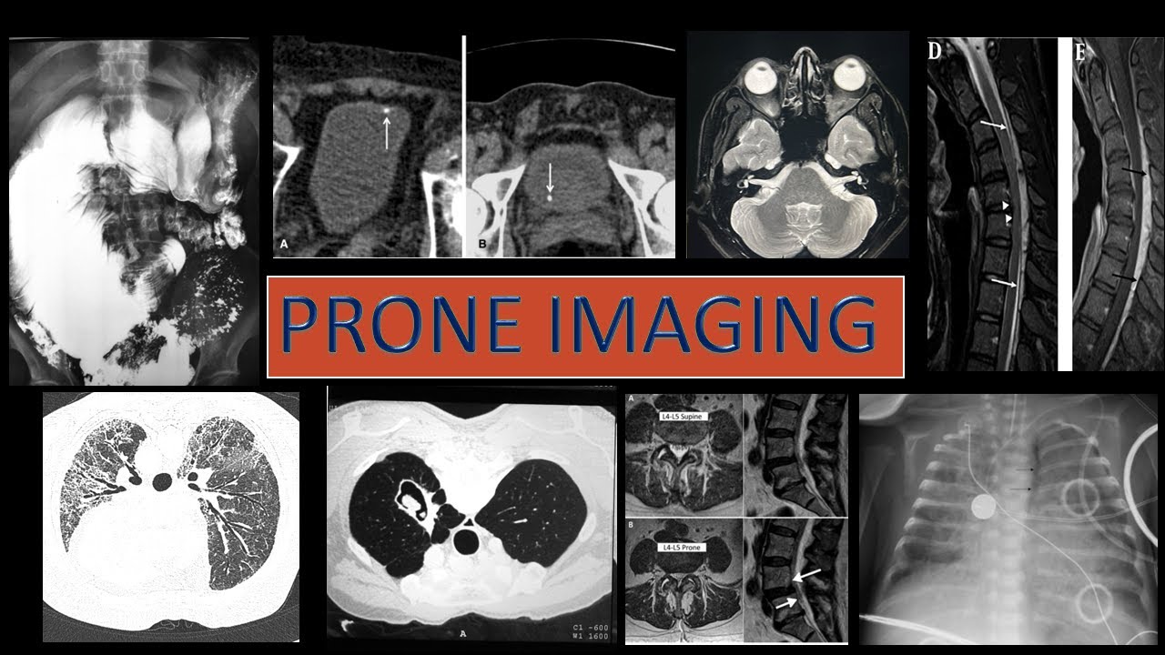 PRONE IMAGING - YouTube