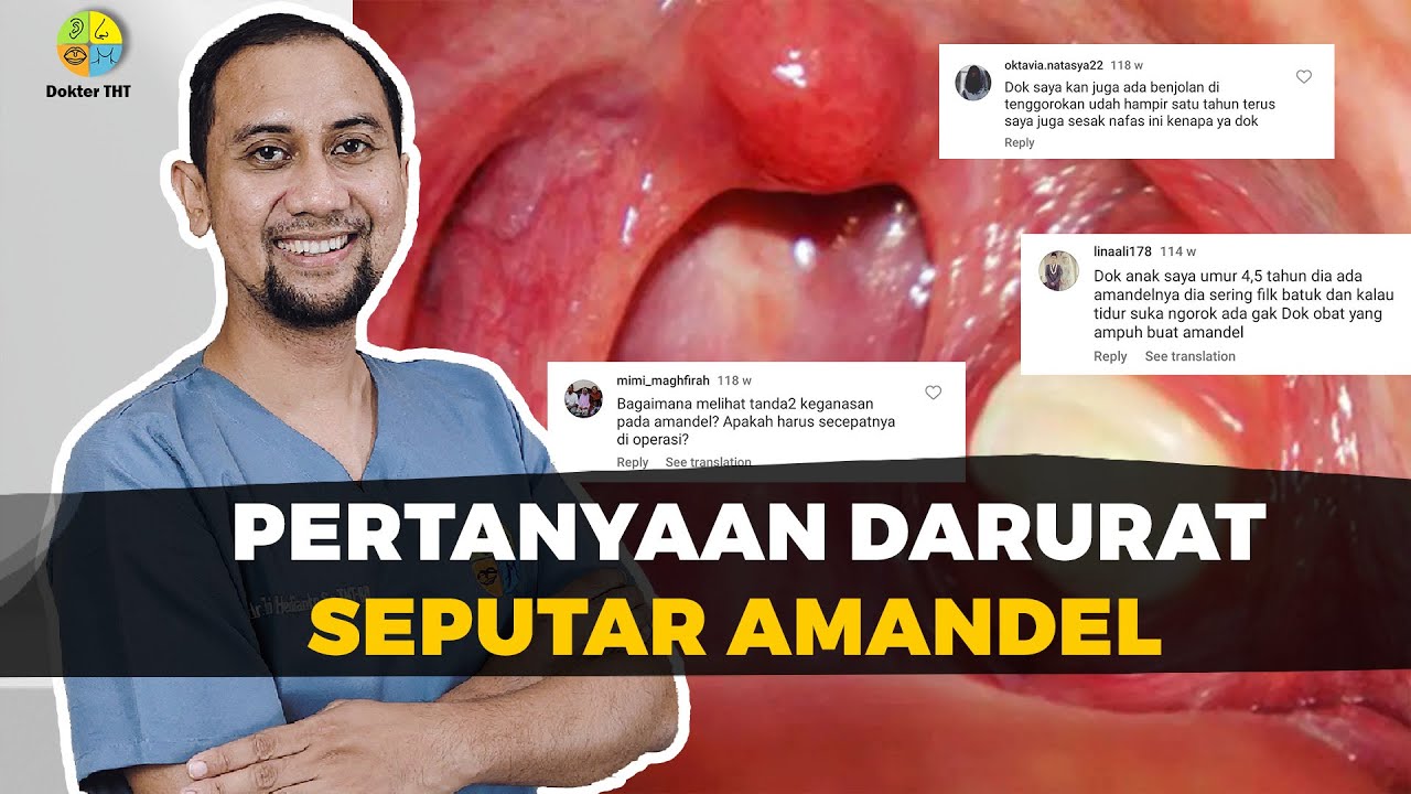 AMANDEL BISA SEMBUH TANPA OPERASI - YouTube