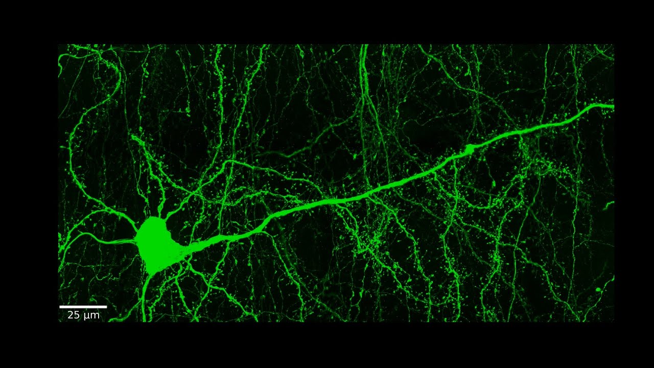 Expansion microscopy with protein staining - YouTube