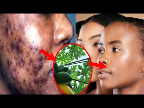 NGUYU UMUTI WIBIHERI BYOMUMASO [IBISHISHI] UKO WAWUKORA UKORESHEJE ...