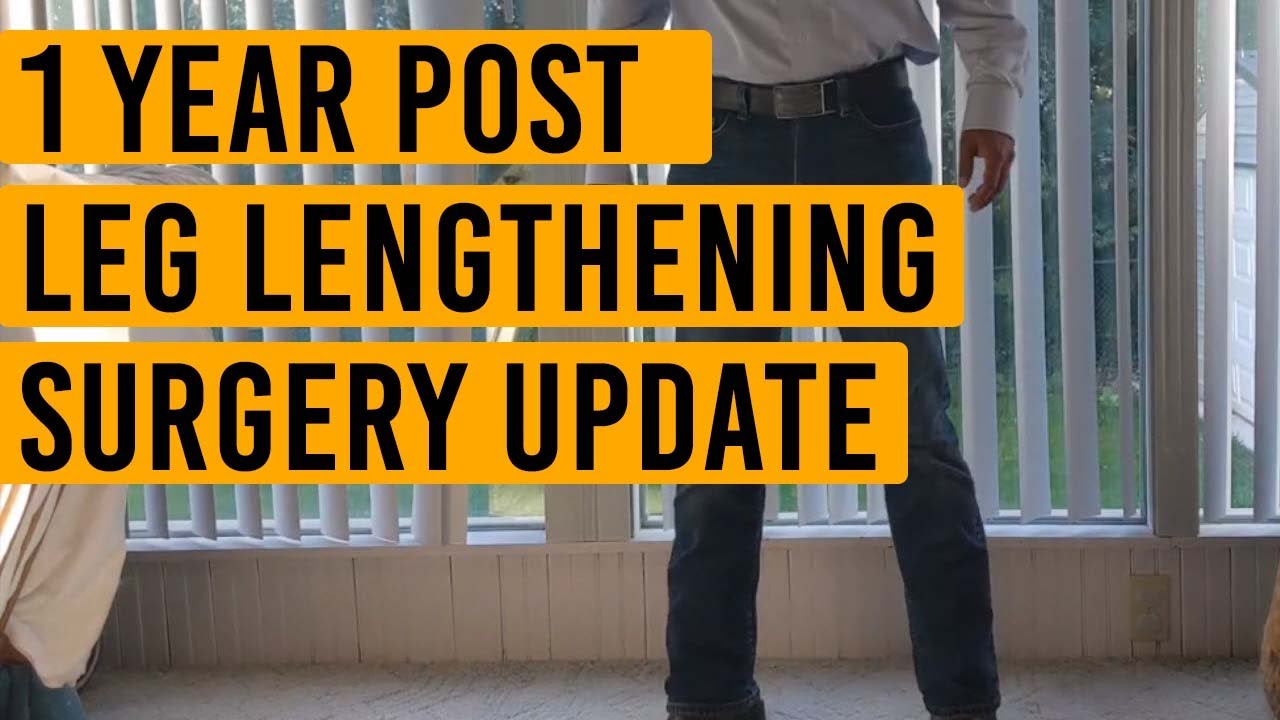 1 year post Leg Lengthening update - YouTube