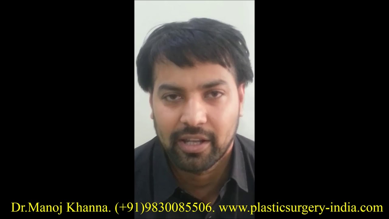 Hair Transplant Cost in Kolkata, India | Dr Manoj Khanna. 9830085506 ...