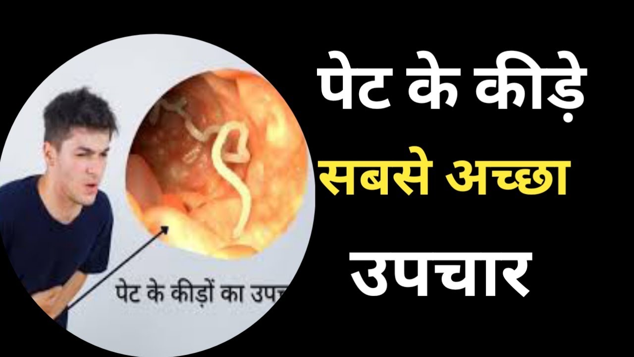पेट के कीड़े होने के लक्षण और उपचार।pet me keede padne ka ilaj - YouTube