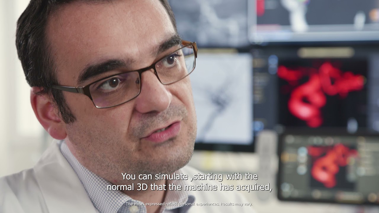 Simplifying and advancing neurovascular device planning with Sim&Cure ...