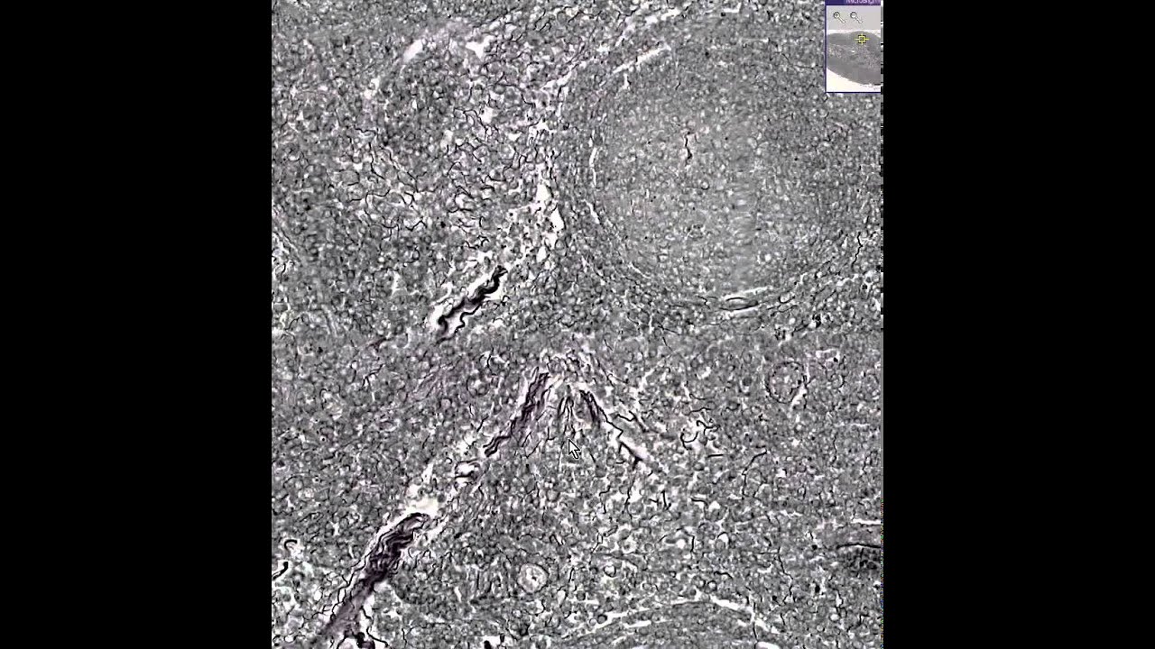 Histology Lymph Node Reticulin Fibers - YouTube