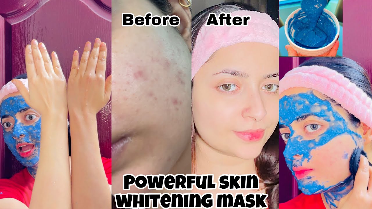 Moroccan Skin Whitening Secret for dark skin ,dark spots and ...