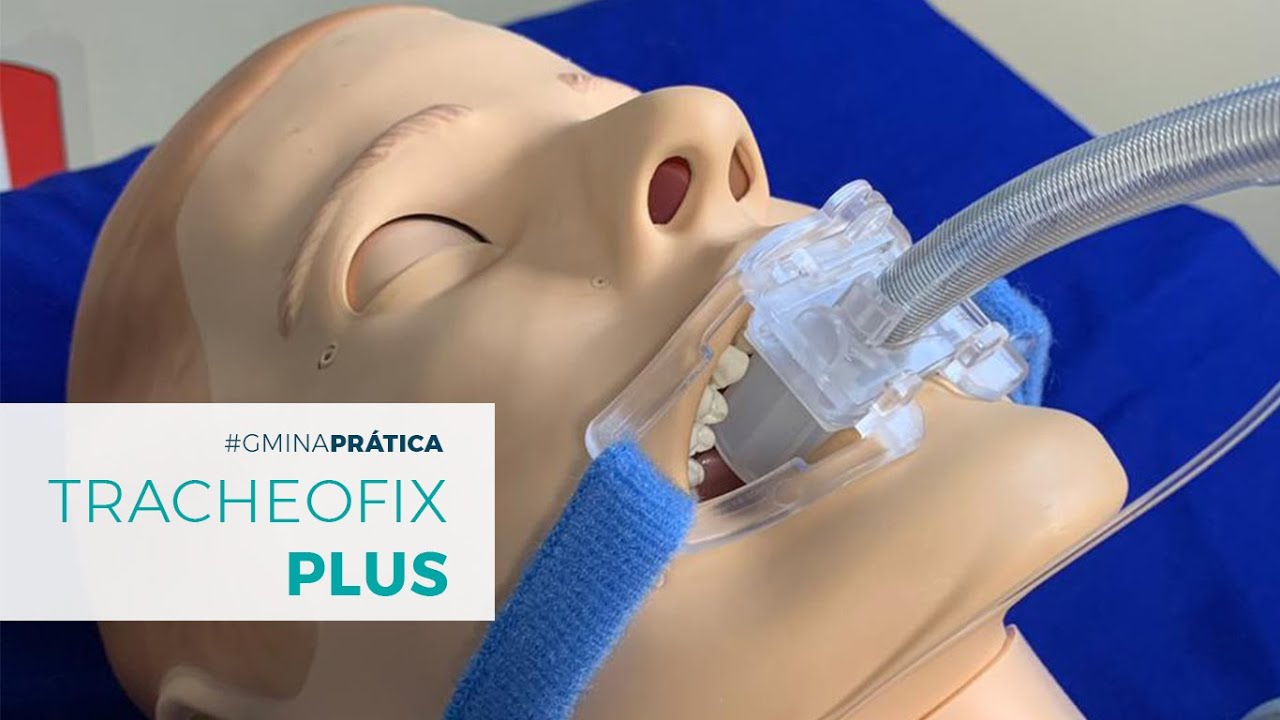 Para Que Serve O Tubo No Aparelho - FDPLEARN