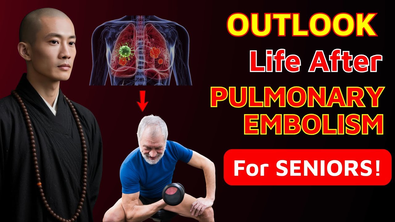 Life Expectancy After PE: What Seniors Need to Know About Recovery ...