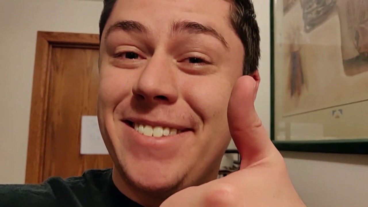 Baby Face to Beard! Starting Minoxidil with No Facial Hair | Week 1 ...