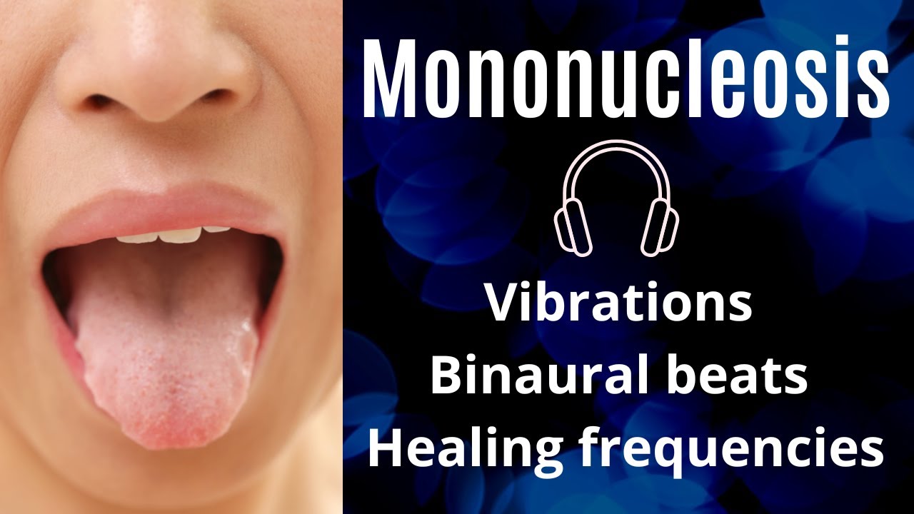 Mononucleosis Treatment (Epstein Barr Virus) - Vibrations | Binaural ...