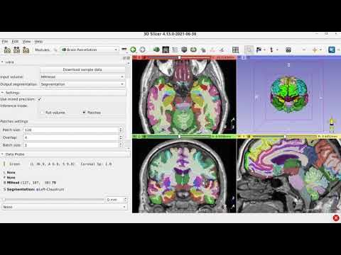 Demo for the Brain Parcellation module of 3D Slicer, which uses a ...