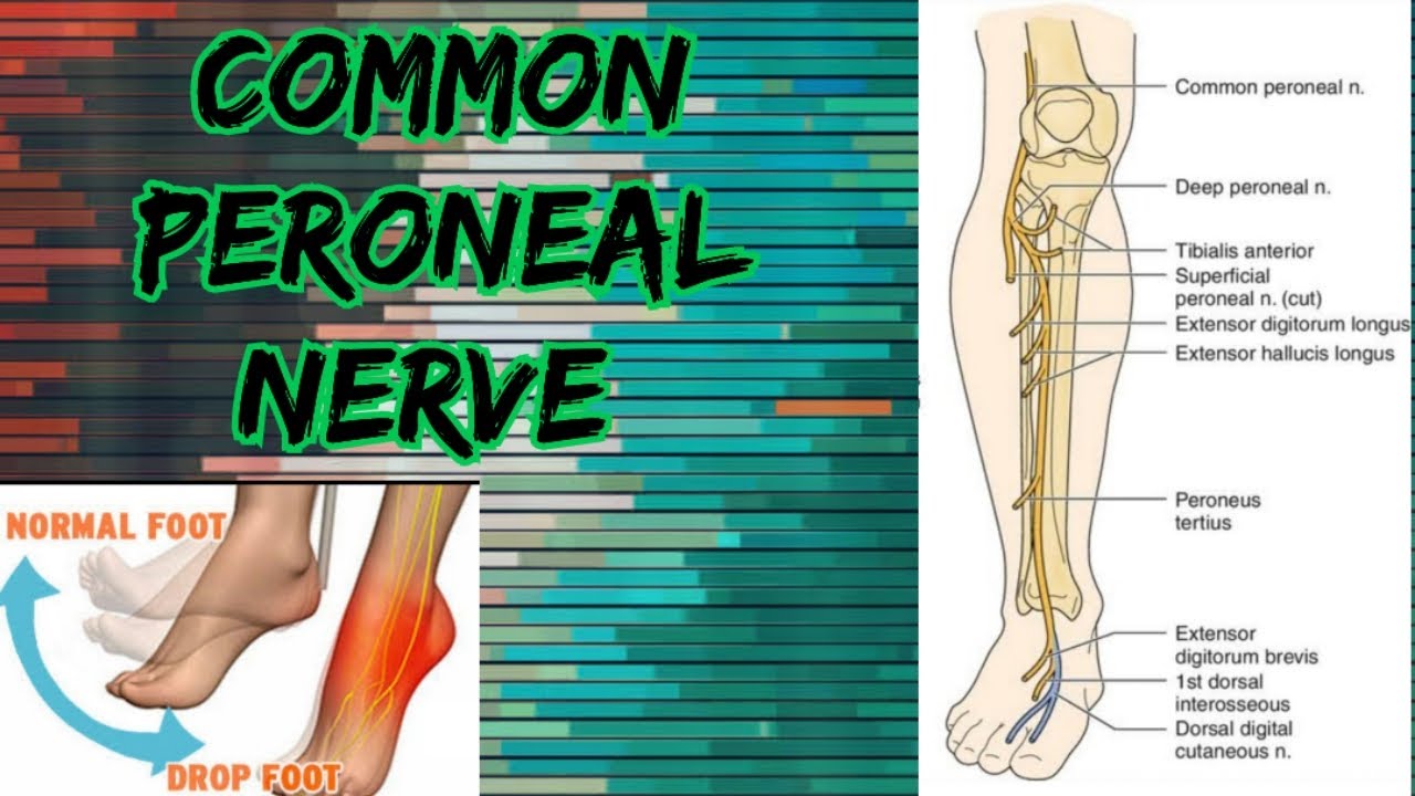 Common peroneal nerve( origin, course,branches, and applied anatomy ...