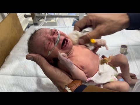 Newborn Baby Received with MSL | Early Cry Mild Cyanosis Lower ...