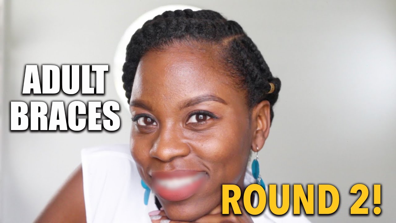 Round #2 | Braces Update - YouTube