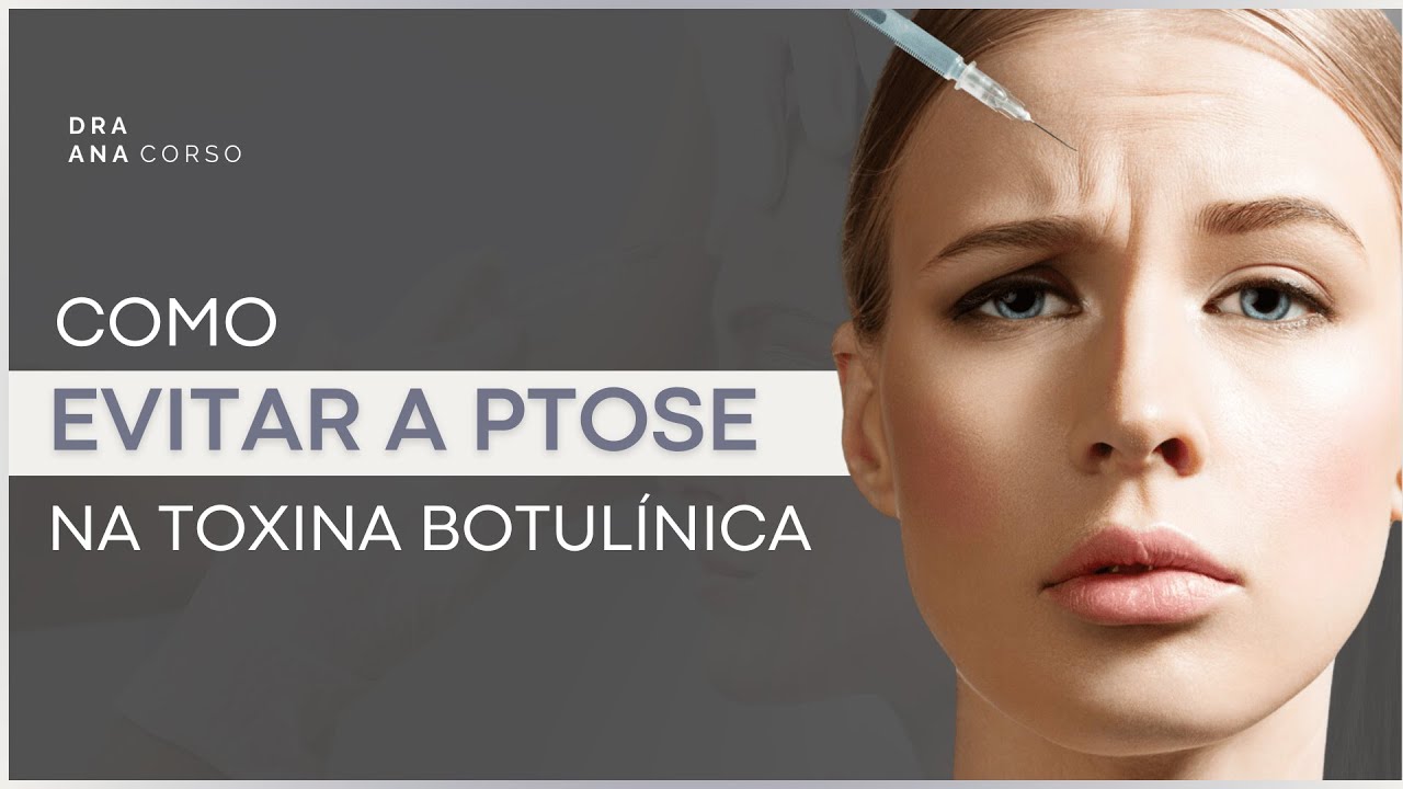 Como evitar a ptose na toxina botulínica - YouTube
