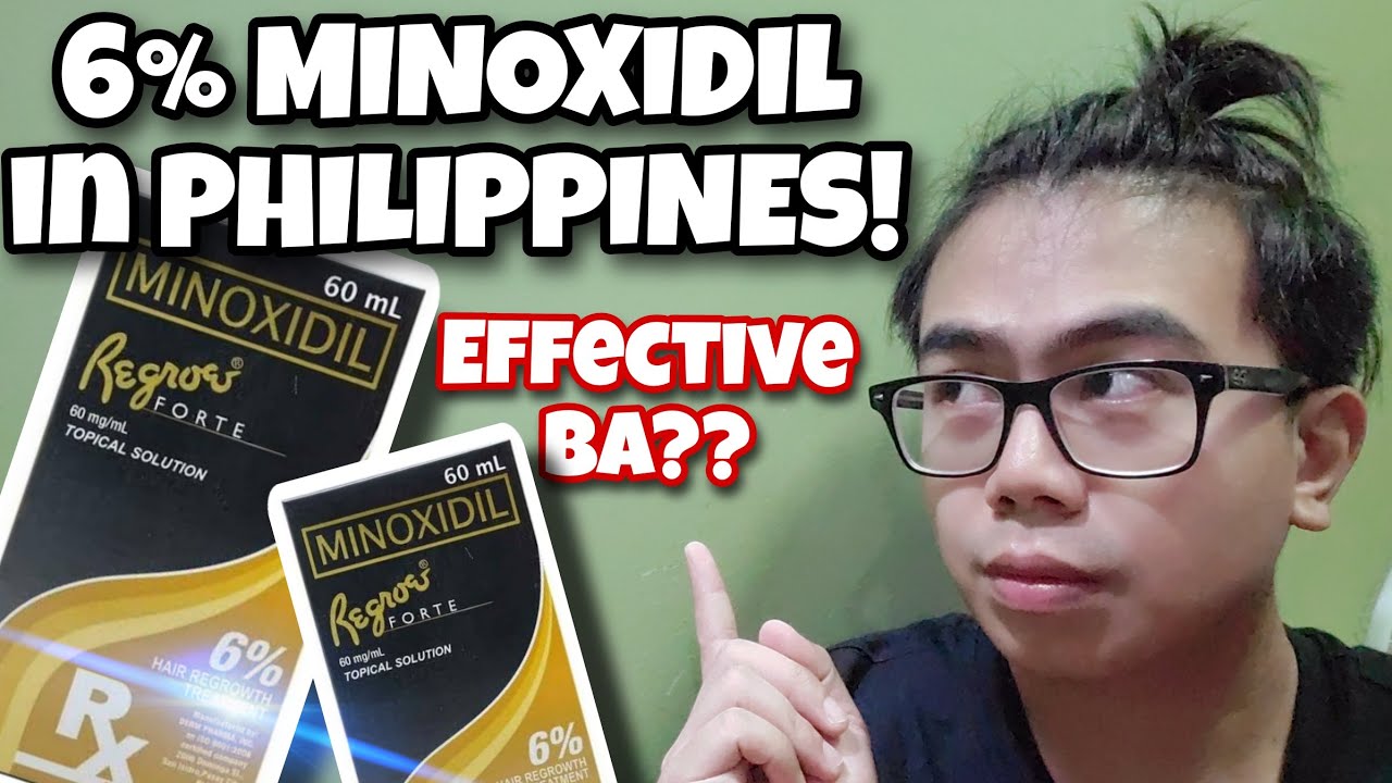 I found a 6% MINOXIDIL here in the PHILIPPINES!! | Is it better and ...