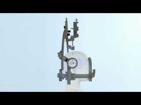 Leksell Stereotactic System® Center of Arc Principle - YouTube