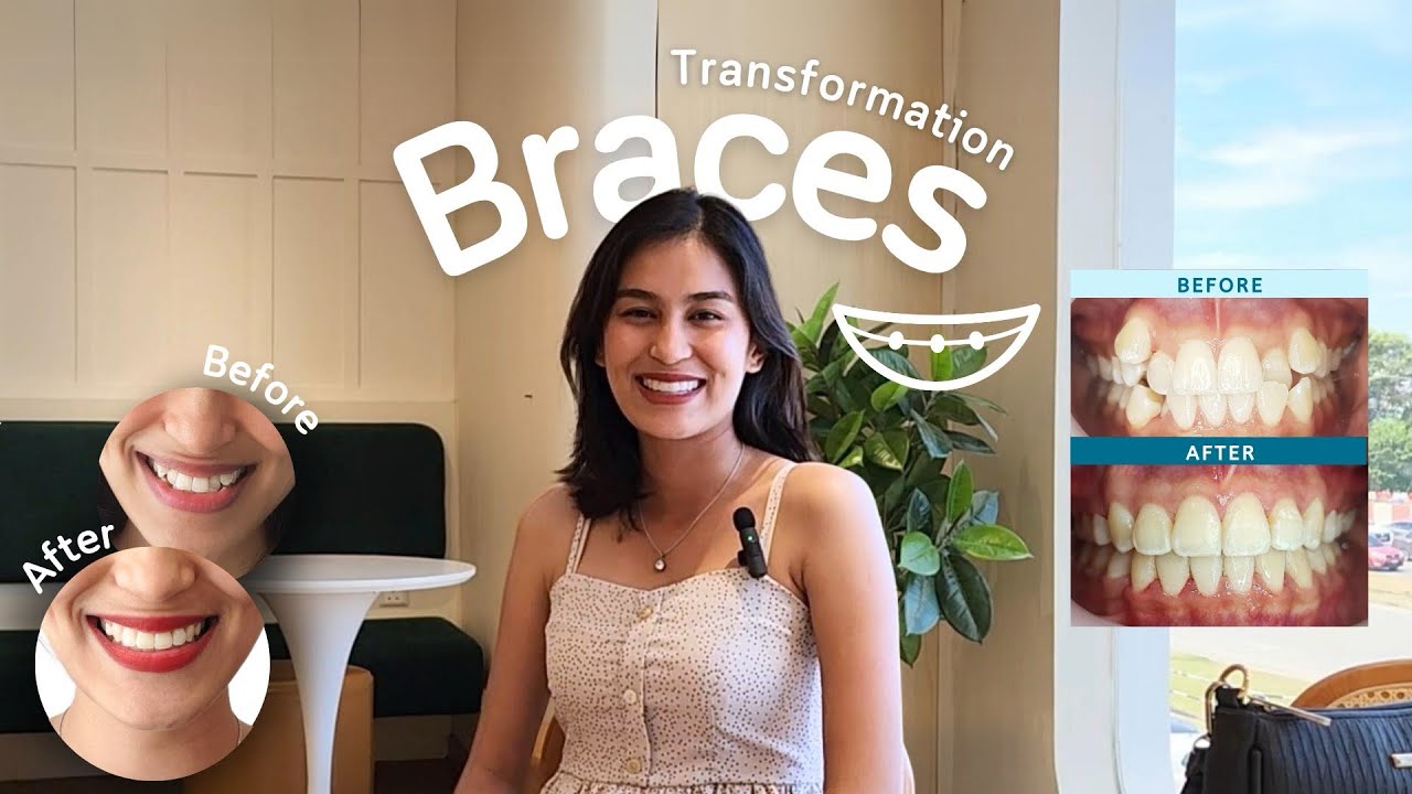 "Because of you, I have a very nice smile, nice teeth and very ...