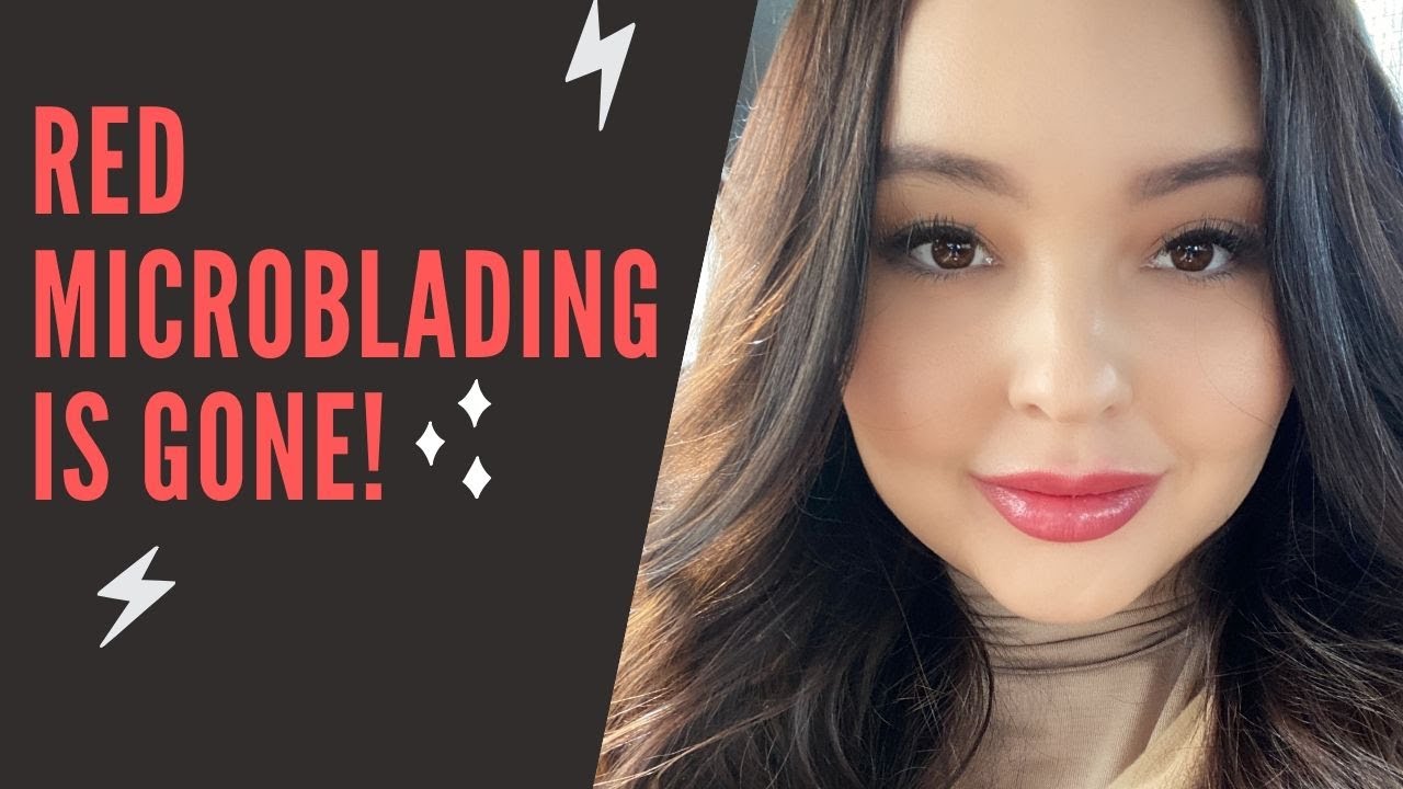 Microblading Nightmare FINALLY OVER! | Removal Update - YouTube