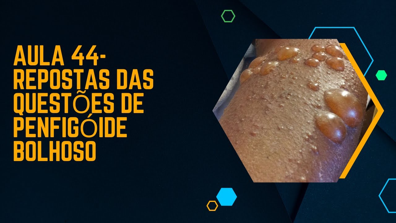 Penfigoide Bolhoso