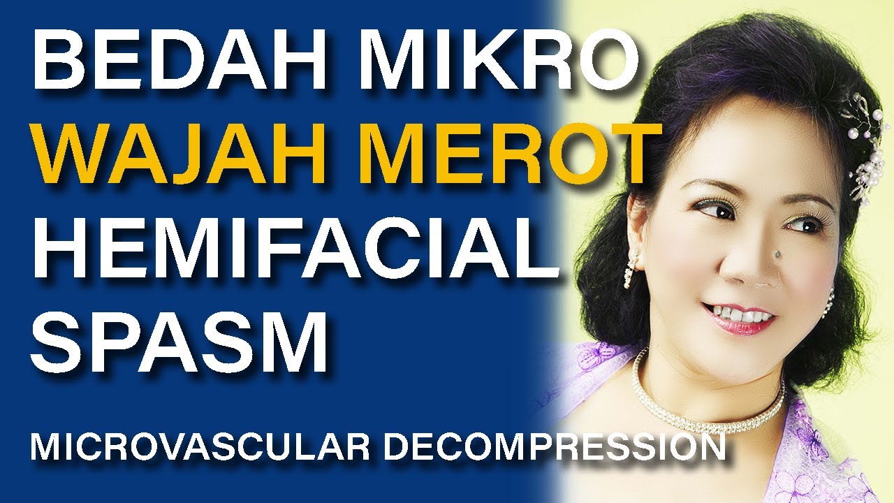 MICRO VASCULAR DECOMPRESSION (MVD) HEMIFACIAL SPASM - YouTube