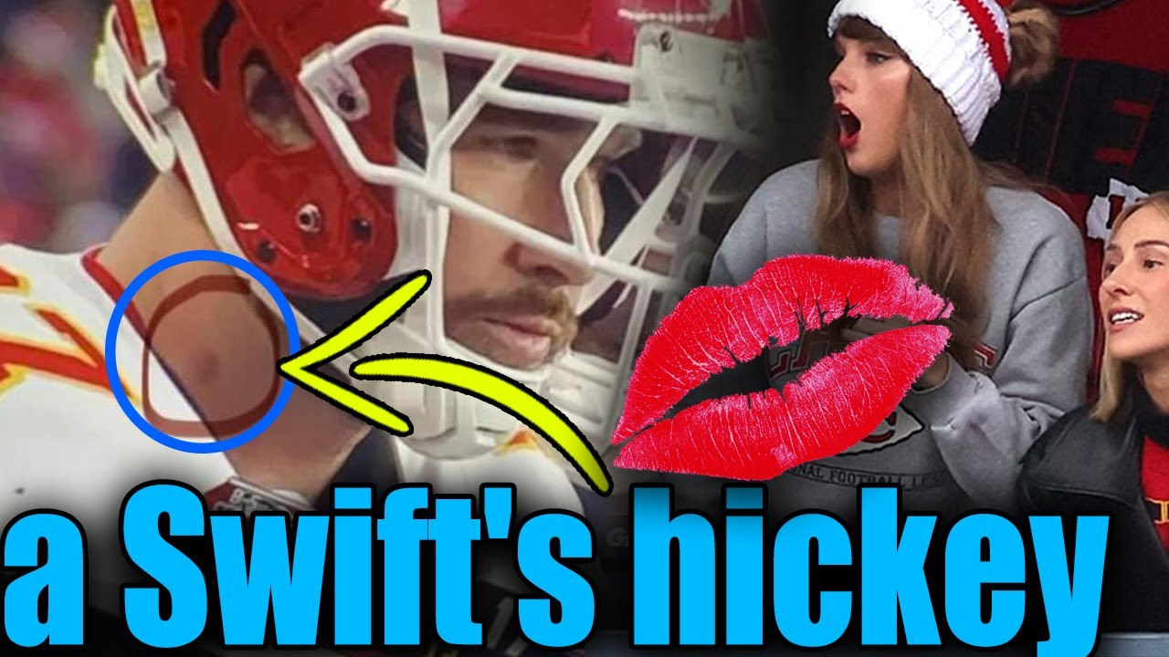 OMG!!! Taylor Swift leave a HICKEY on Travis Kelce's neck - YouTube