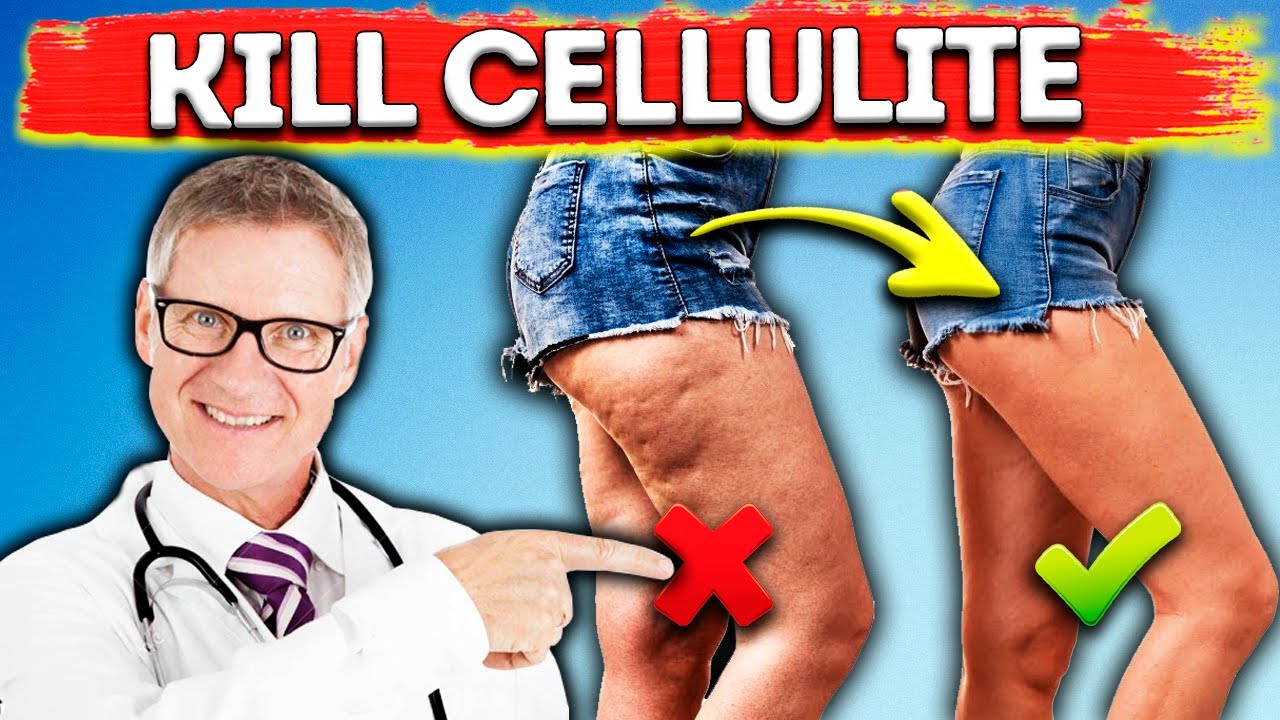 The secret way to get rid of cellulite forever - YouTube