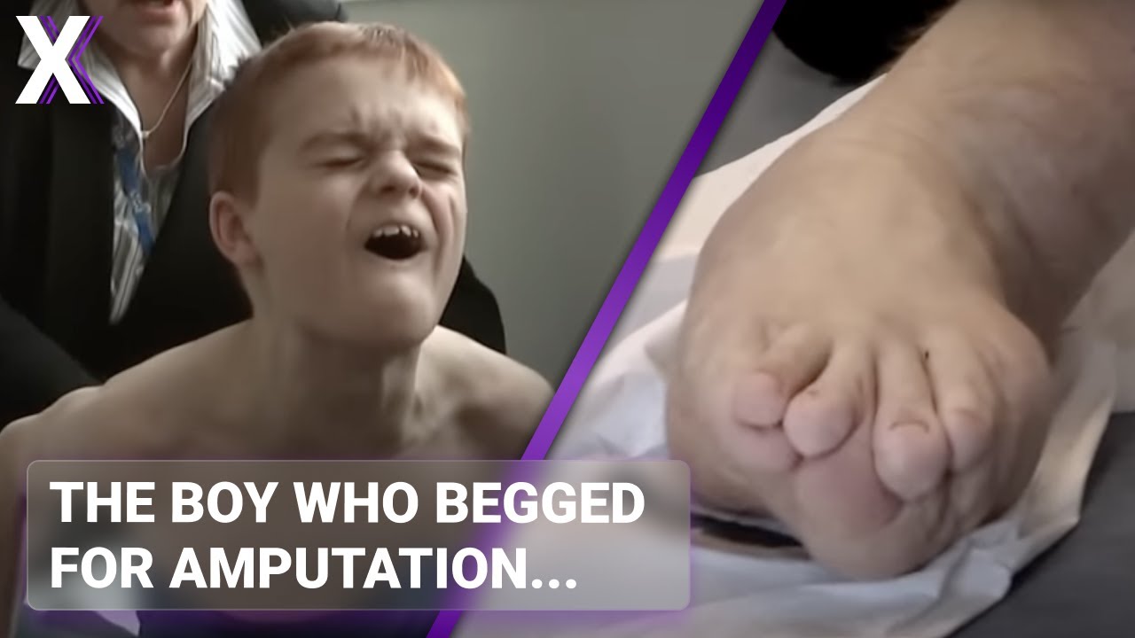 Dillon Chapman’s Fight for a Normal Life - YouTube