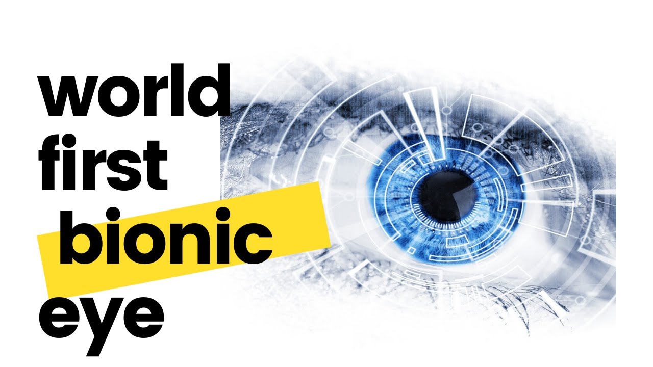 Bionic eye for blind | bionic eye | bionic eye 2020[English] - YouTube