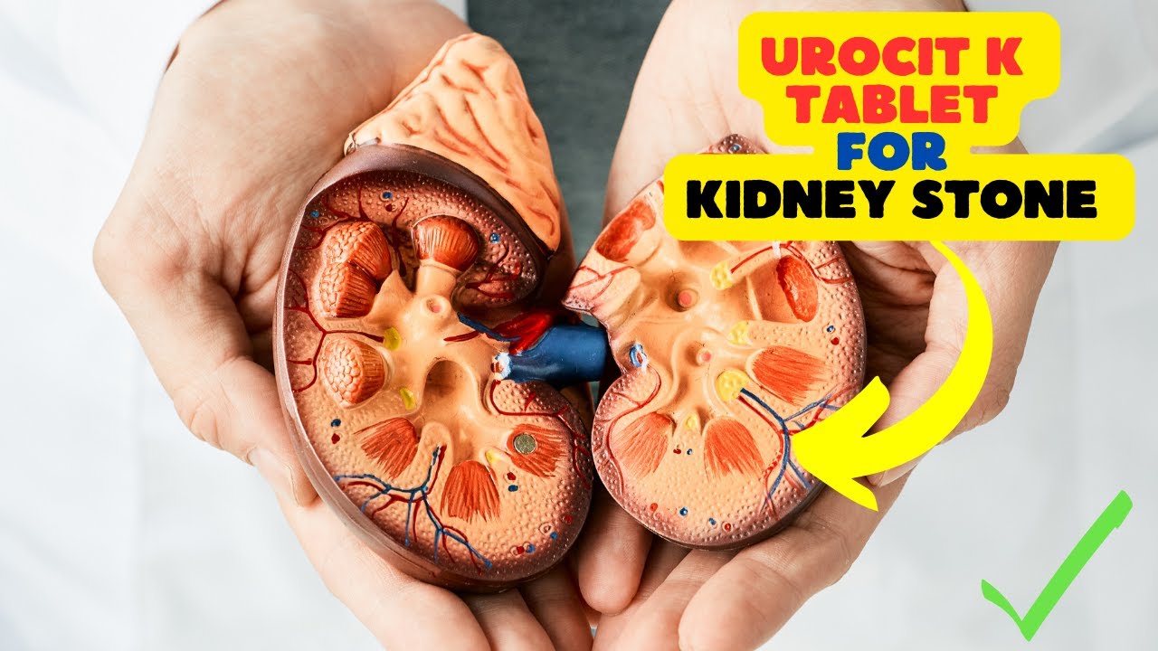 Urocit K Tablet: Understanding Its Common Uses in Kidney Stone Prevention. - YouTube