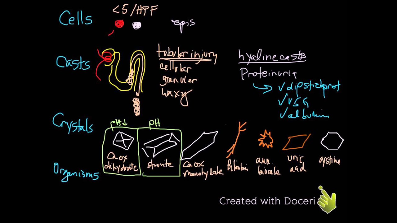 urinalysis - sediment examination - YouTube