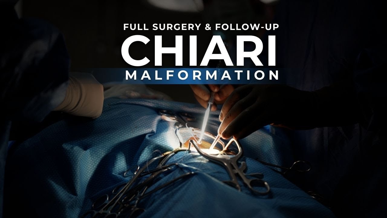 Chiari Malformation Surgery - Beginning to End (FULL Surgery & Follow ...