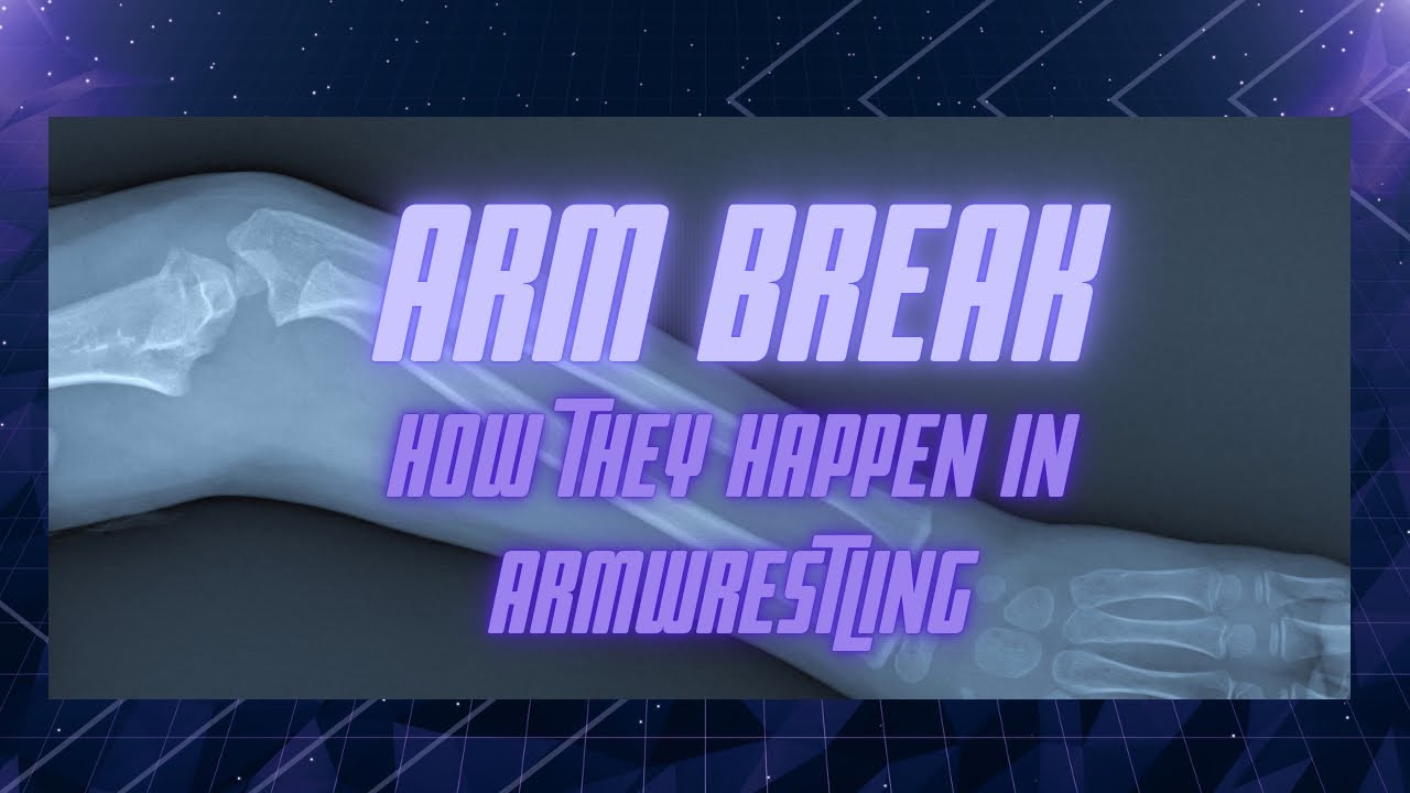 Arm Break. How They Happen In Armwrestling - YouTube