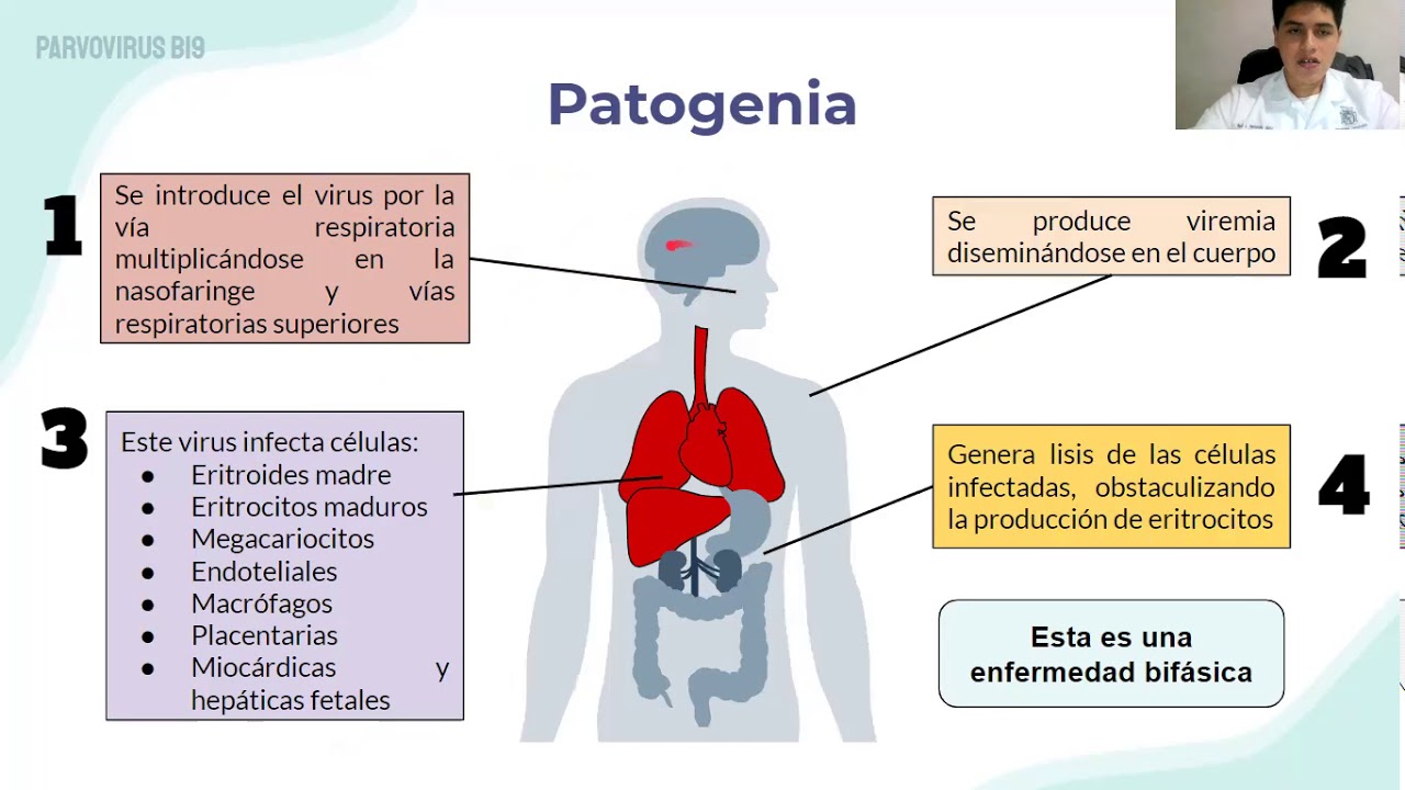 Parvovirus B19 - YouTube