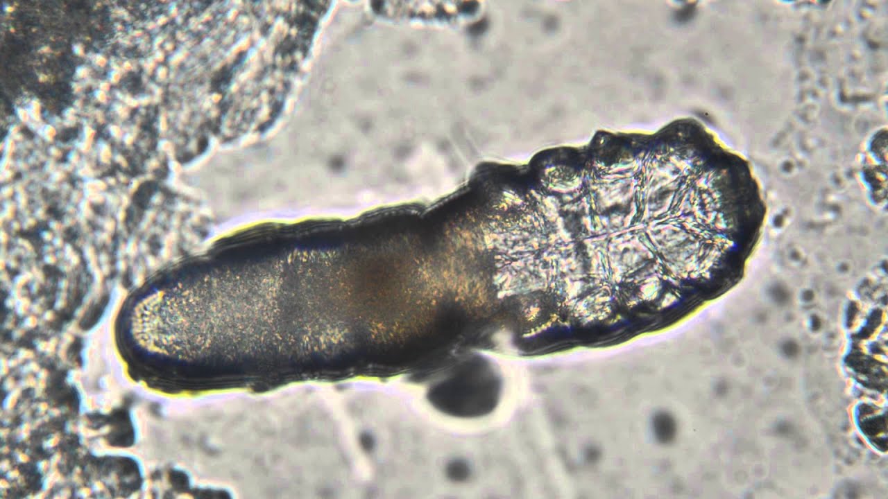 Demodex face mite - YouTube