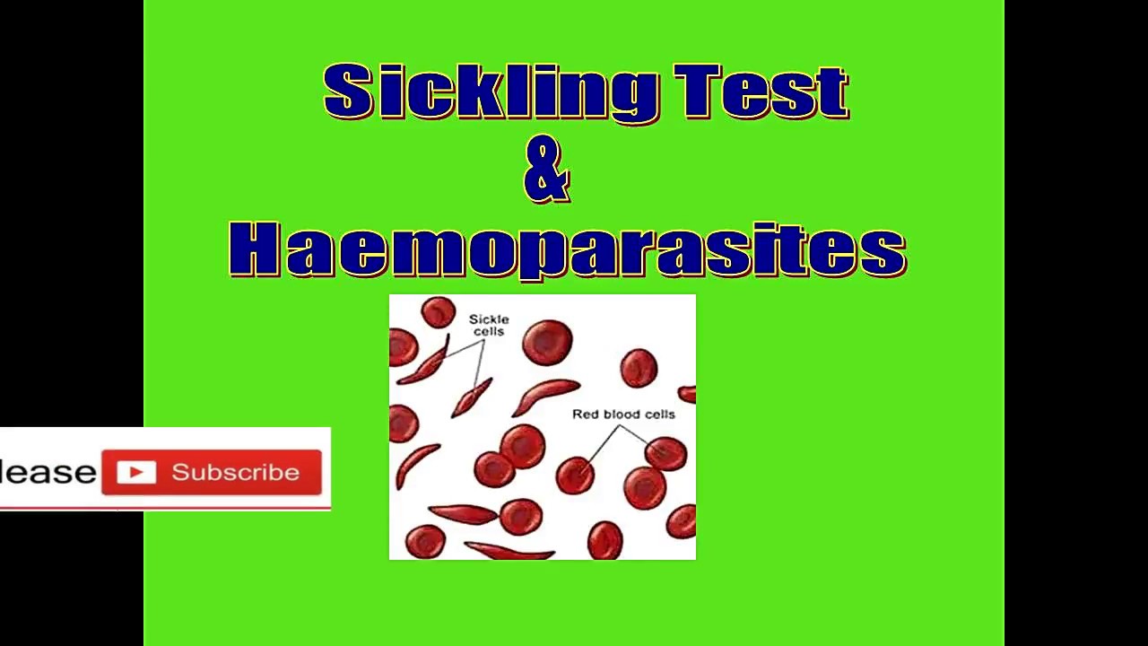 Sickling Test & Haemoparasites - YouTube