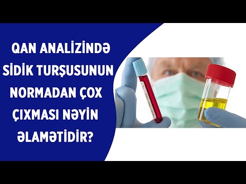 Qanın analizində sidik turşusunun normada və ya normadan çox olmağı nəyin əlamətidir?