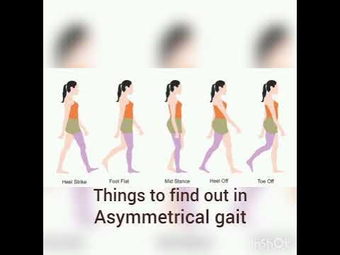 # Let's learn about symmetrical and asymmetrical gait pattern - YouTube