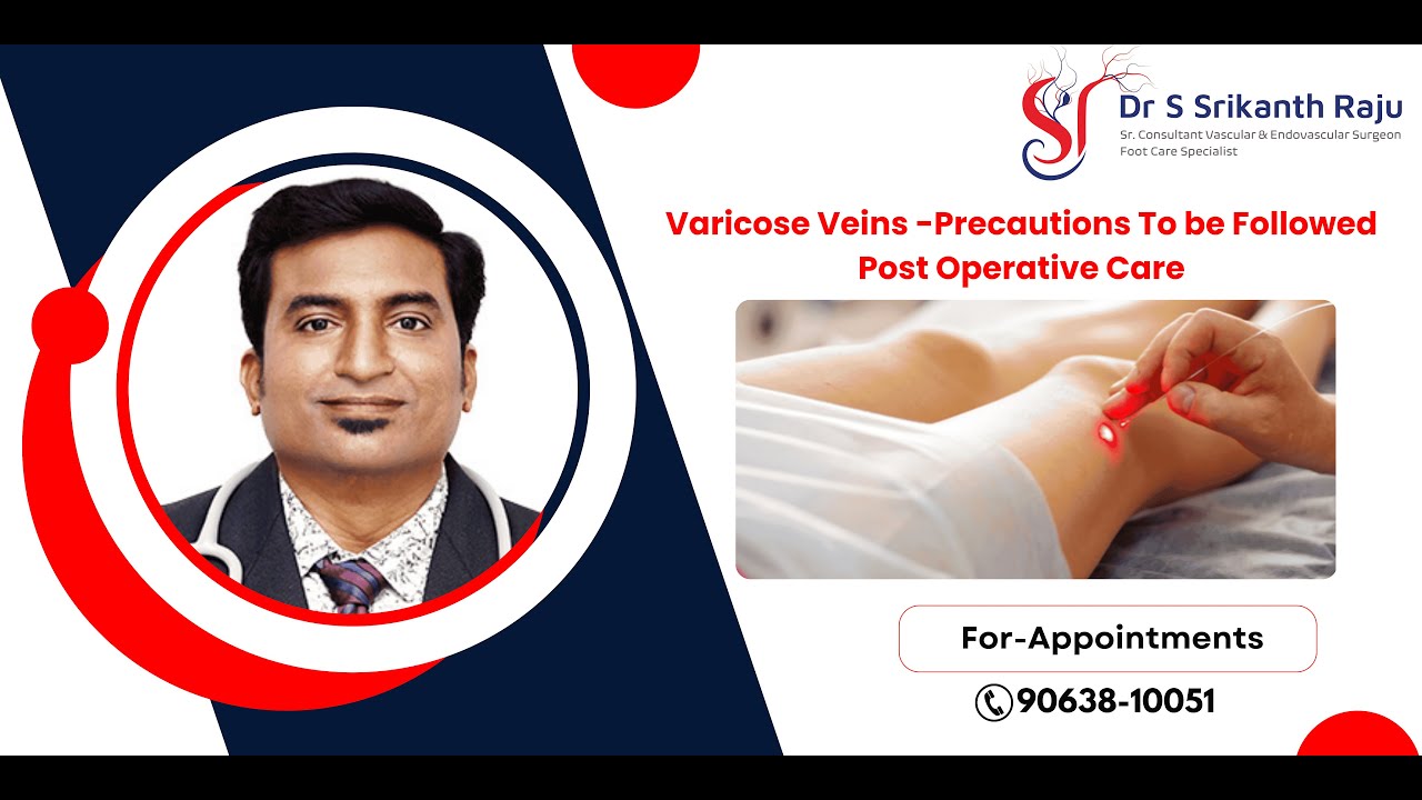 Varicose Veins Precautions | Post-Operative Care | Dr.S.Srikanth Raju ...